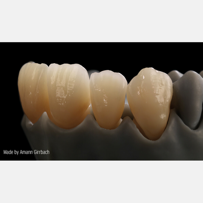 AG Zolid FX Preshade (SHT) - Abutment Direct