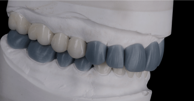 Harvest Dental Pressing wax - Abutment Direct